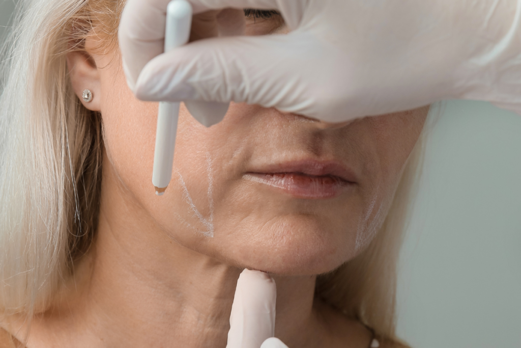 How Can AlloClae Be Used For Fat Transfer Cases ...